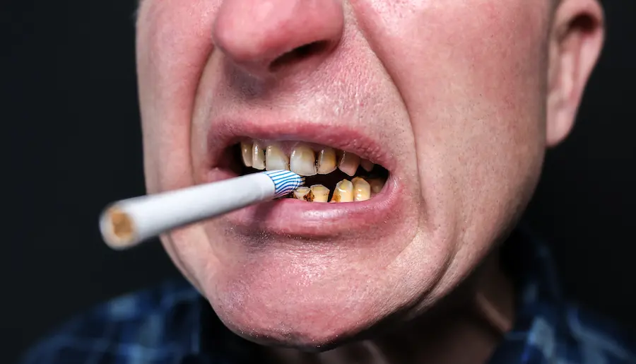 Consecuencias del Tabaco para la Salud Oral - Cleardent