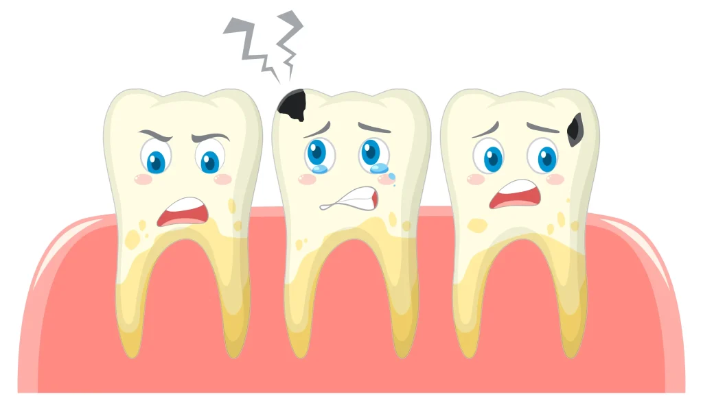 Tipos de caries: Cuántas hay y cómo tratarlas - Cleardent